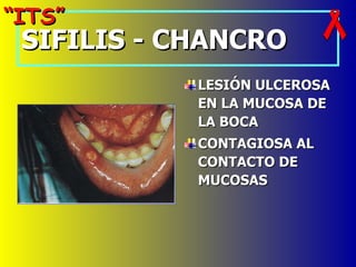 Infecciones de transmisión sexual | PPT