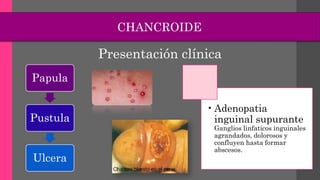 Infecciones de transmisión sexual | PPTX