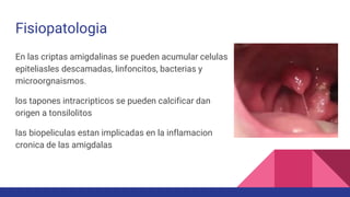 Infecciones de vías respiratorias altas.pptx