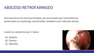 Infecciones de vías respiratorias altas.pptx