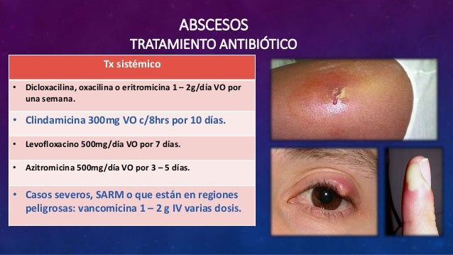 Infecciones en cirugía 2da parte