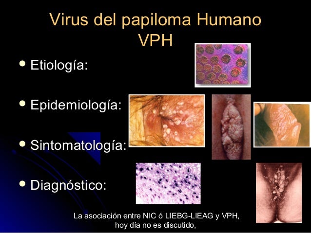 Infecciones Genitales
