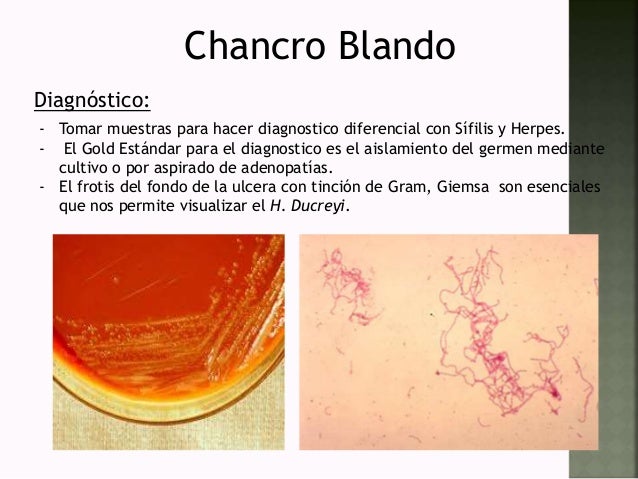 Infecciones ginecologicas