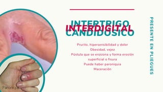 Infecciones micóticas | PPTX