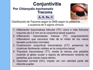 Infecciones oculares | PPTX