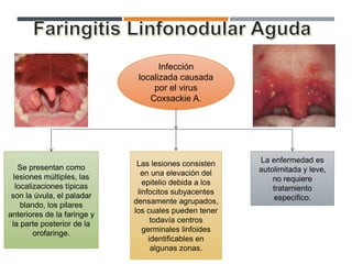 INFECCIONES ORALES VÍRICAS | PPTX