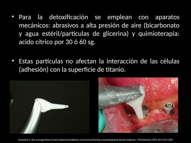 Infecciones periimplantarias alrededor de implantes periodoncia | PPT