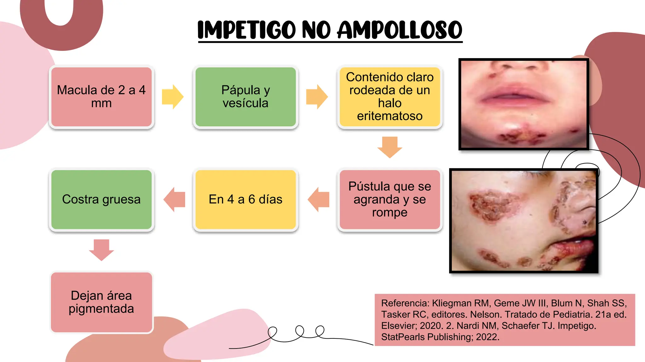 Infecciones de la piel y partes blandas(Impétigo, celulitis, erisipela ...