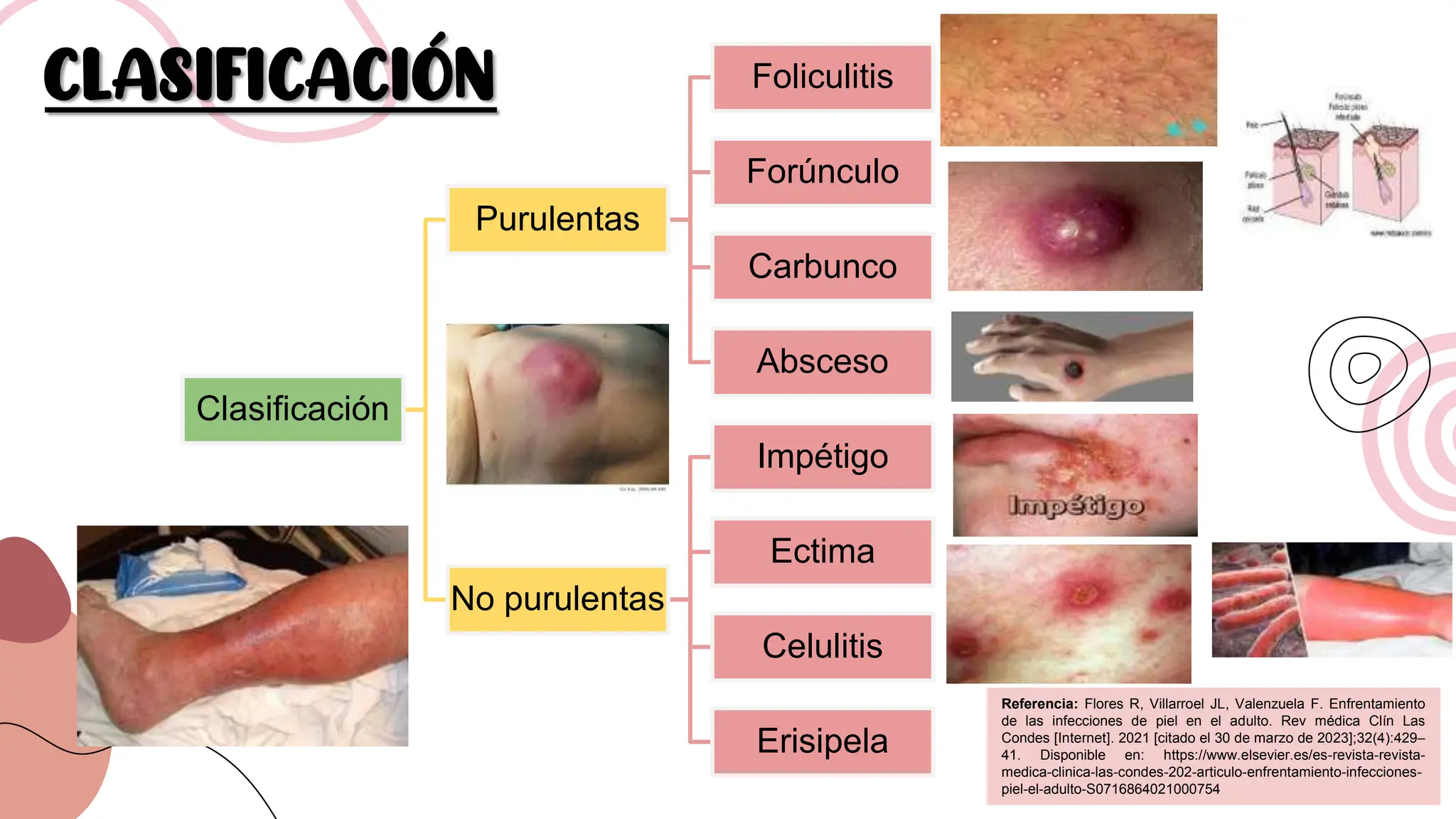 Infecciones de la piel y partes blandas(Impétigo, celulitis, erisipela ...