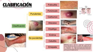 Infecciones de la piel y partes blandas(Impétigo, celulitis, erisipela ...