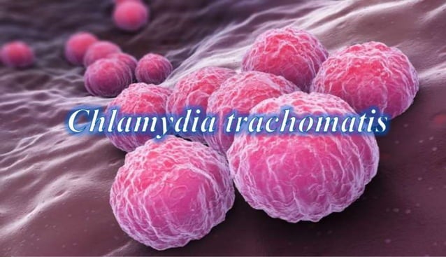 Infecciones por chlamydia | PPTX