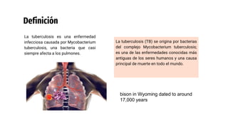 generalidades sobre tuberculosis r1 de medicina interna | PPTX
