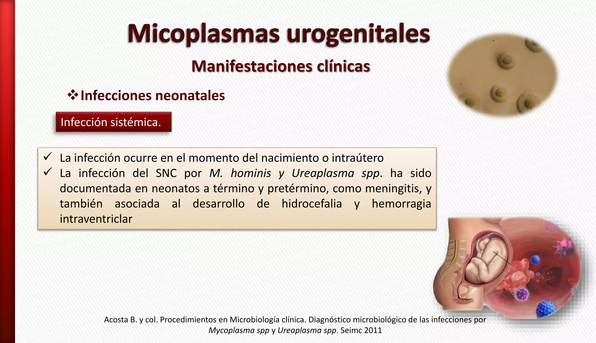 Infecciones Por Mycoplama Y Ureaplasma Pptx