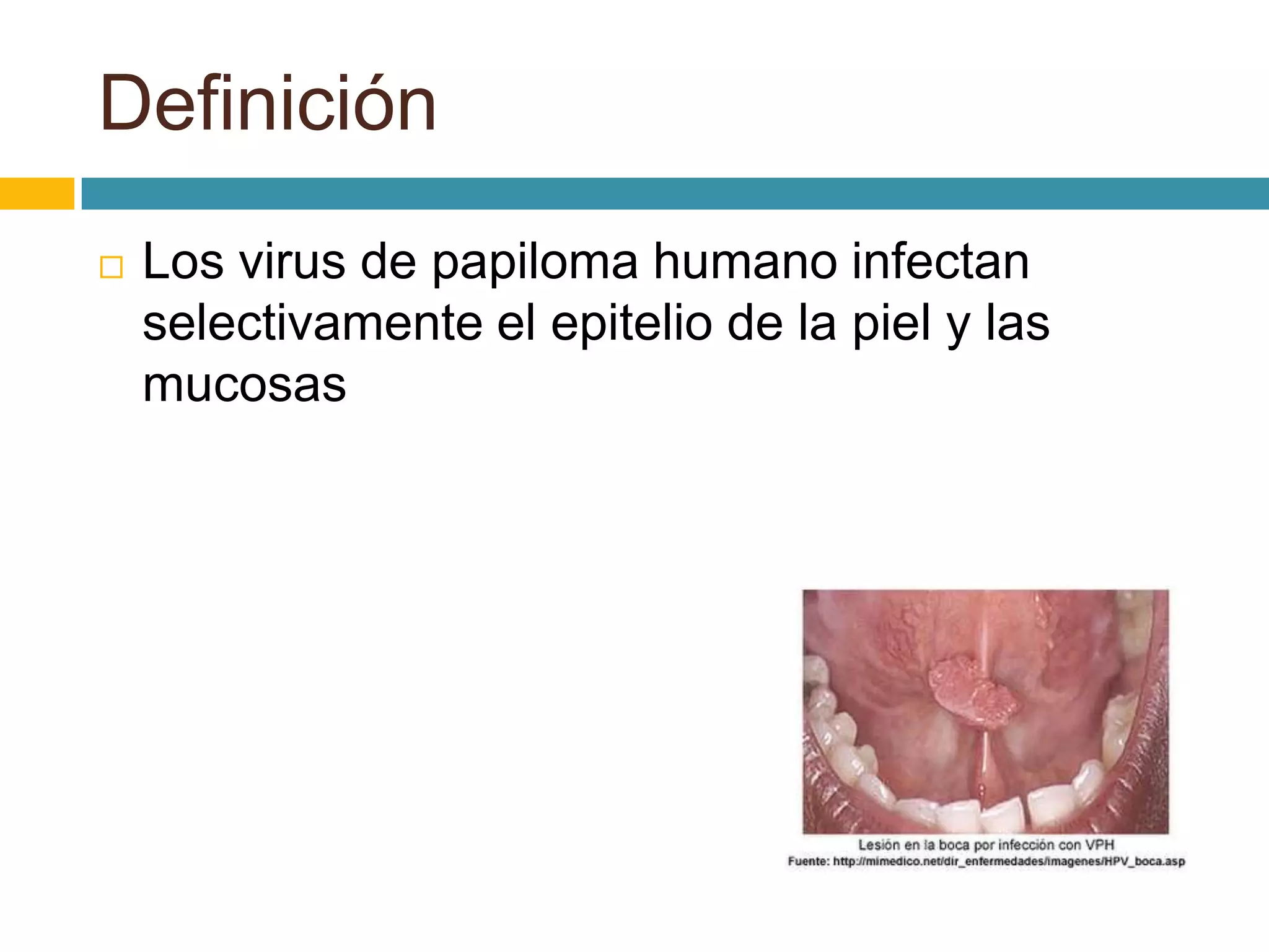 Infecciones por virus de papiloma humano | PPTX