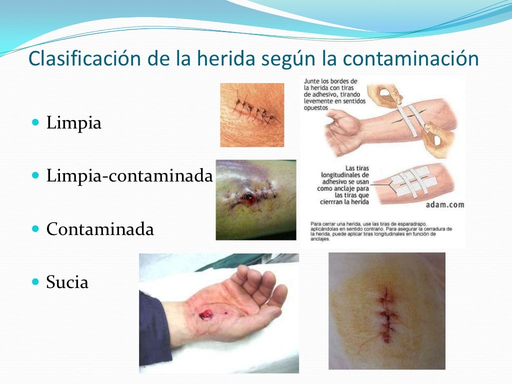 Infecciones quirurgicas y eleccion de antibioticos