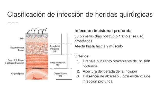 Infecciones Quirúrgicas