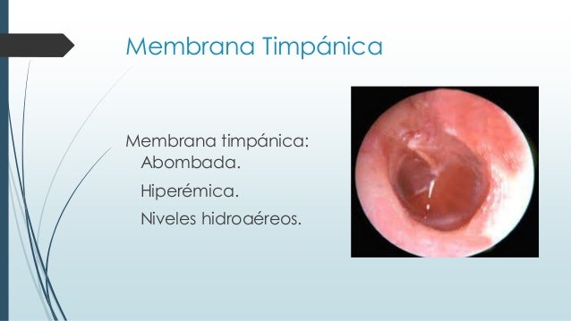Infecciones respi