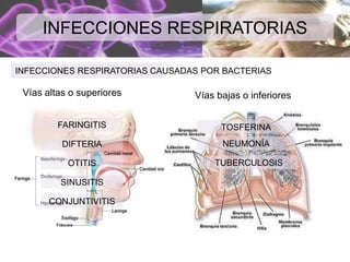INFECCIONES RESPIRATORIAS | PPTX
