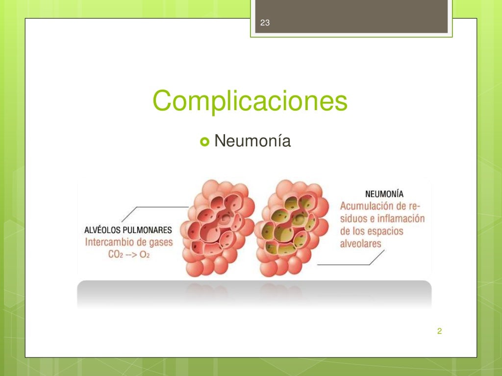 Infecciones Respiratorias Agudas En Menores De 5 Años