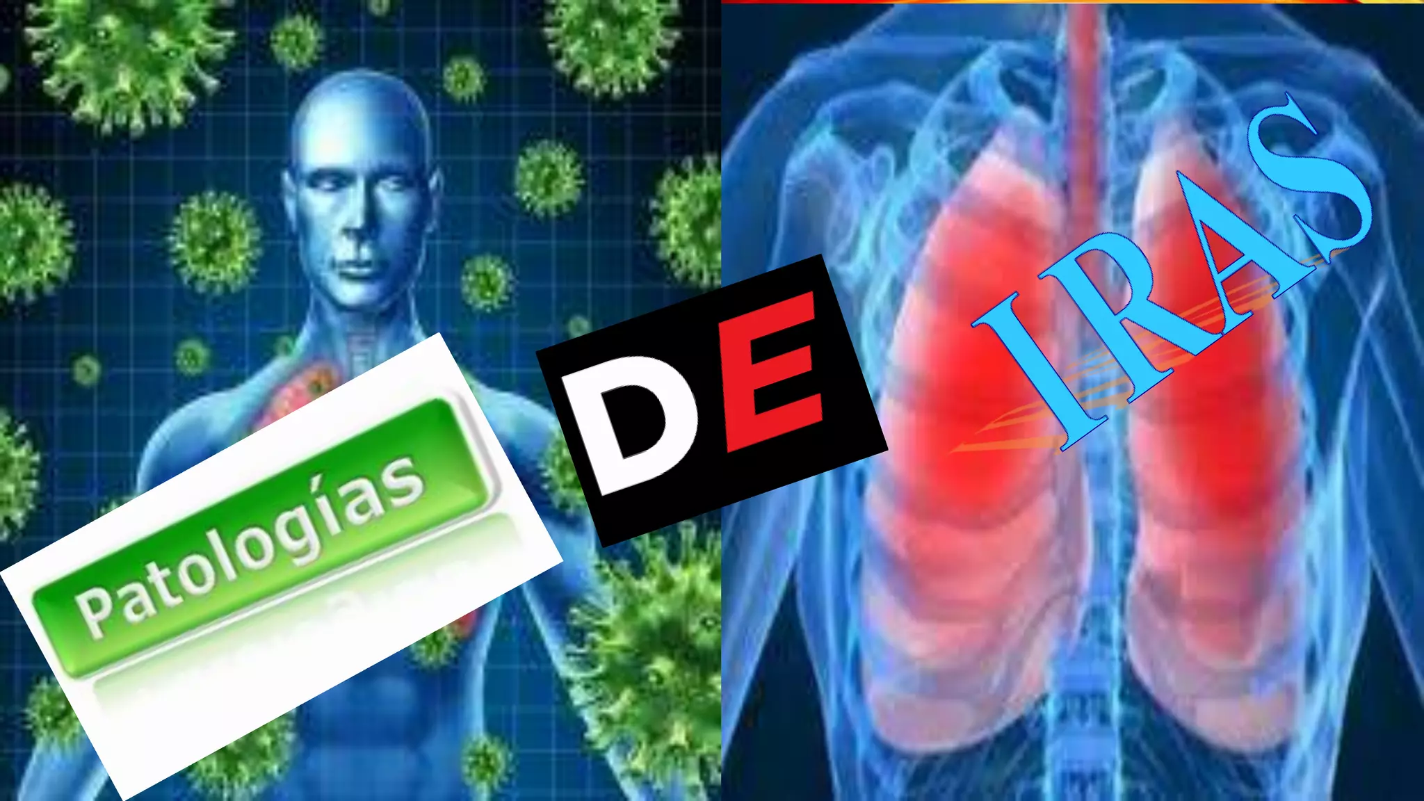 Infecciones Respiratorias Agudas Iras Ppt