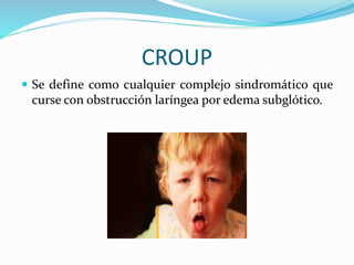 INFECCIONES RESPIRATORIAS ALTAS.pptx