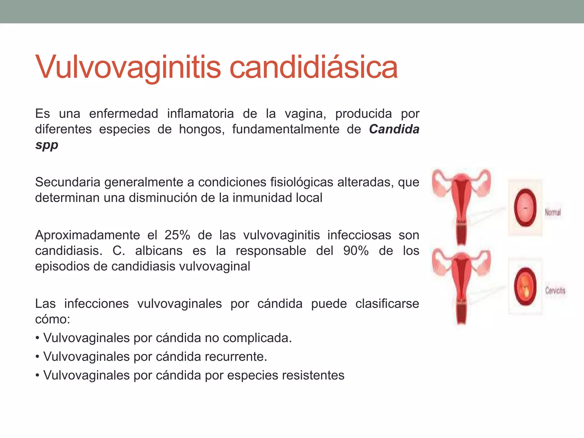 Infecciones vaginales por bacterianas y hongos.pptx