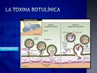 CLOSTRIDIUM TETANI - TETANOS - FISIOPATOLOGIA | PPT