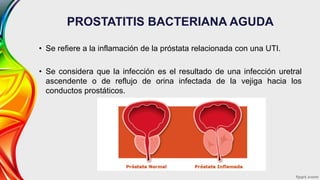Infección Prostática | PPTX