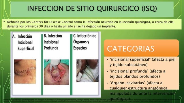 Infeccion sitio quirurgico