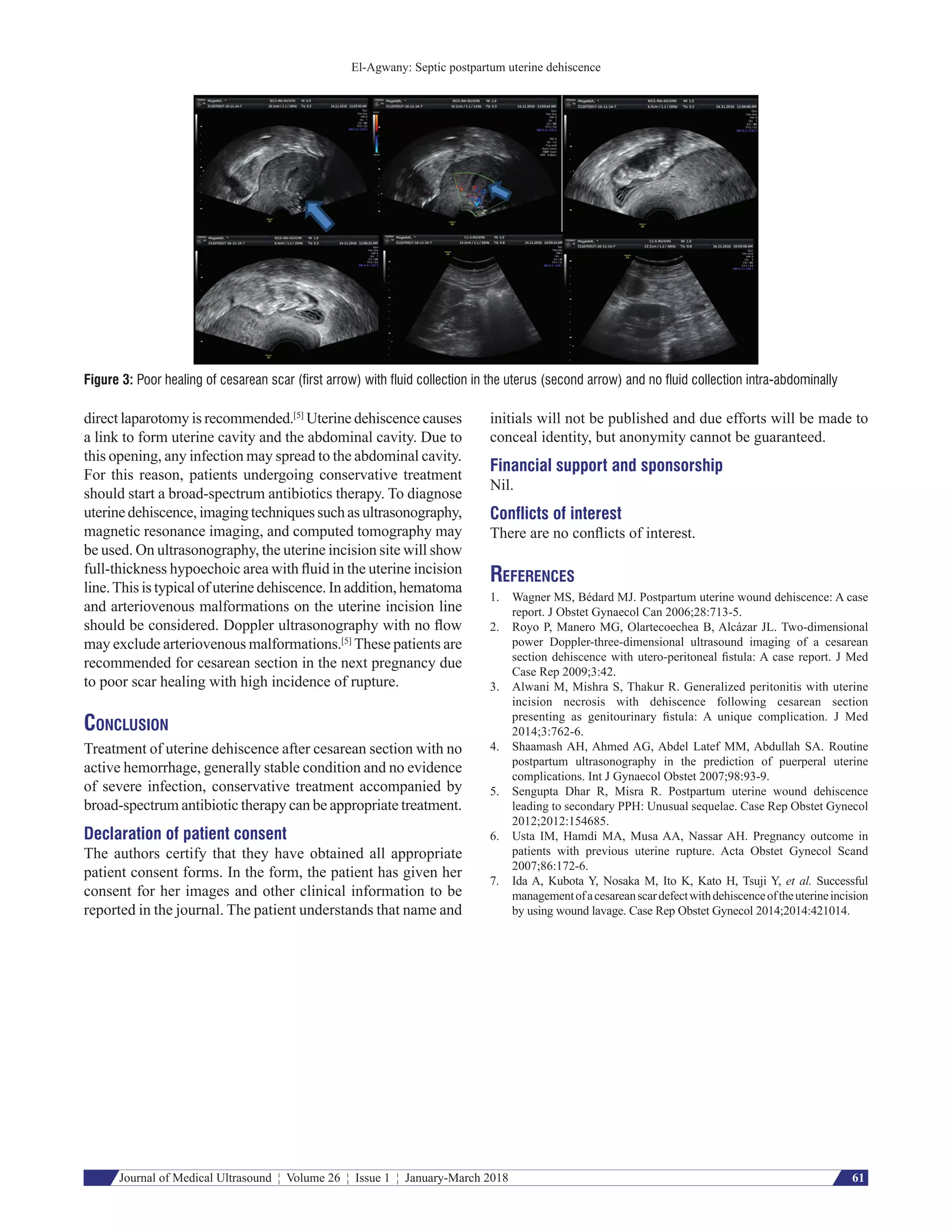 Infected cesarean section scar | PDF | Pregnancy | Reproductive Health