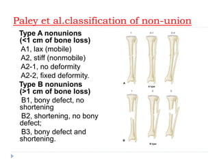 Infected non union | PPTX