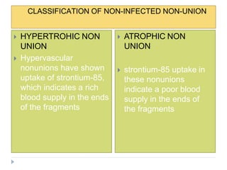 INFECTED NON UNION1 .pptx