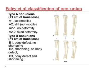 INFECTED NON UNION1 .pptx