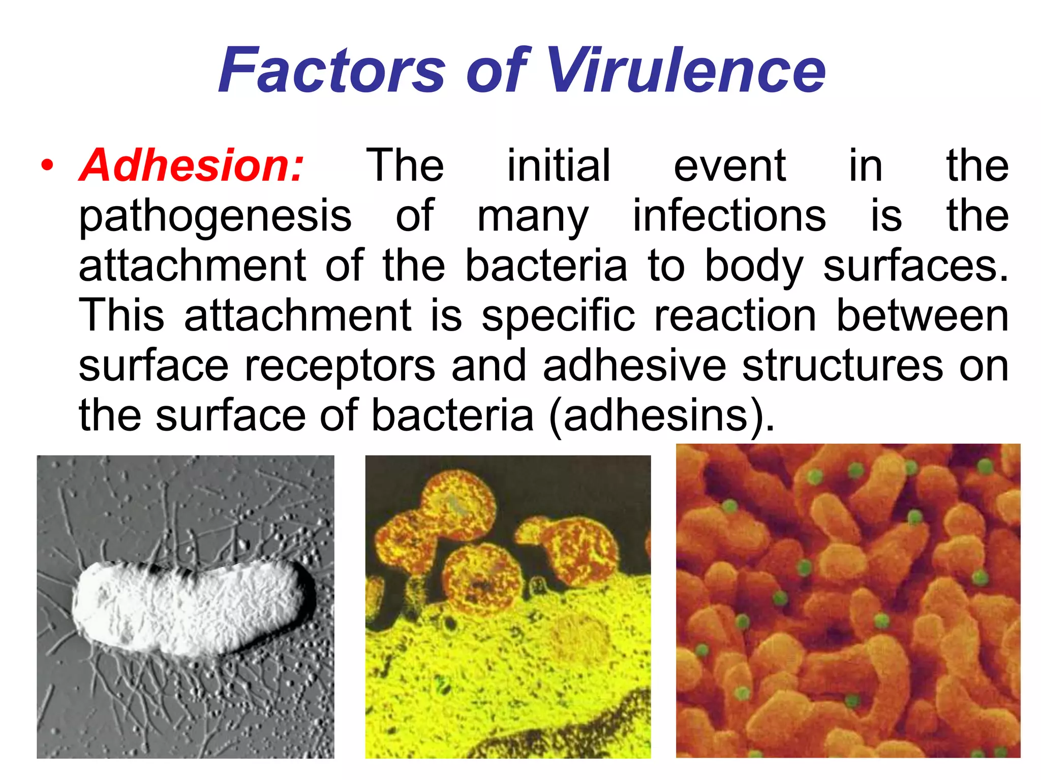 INFECTION.ppt