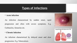 Infections: Types, Sources, Routes and Spread of Infectious diseases.pptx