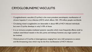 "Infection-Associated Vasculitis: Clinical Insights and Case Based ...