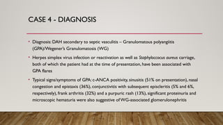 "Infection-Associated Vasculitis: Clinical Insights and Case Based ...