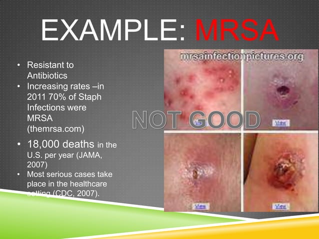 Infection control and The Blood Pressure Cuff | PPTX | First Aid | Injuries