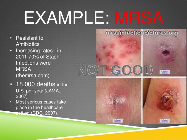 Infection control and The Blood Pressure Cuff