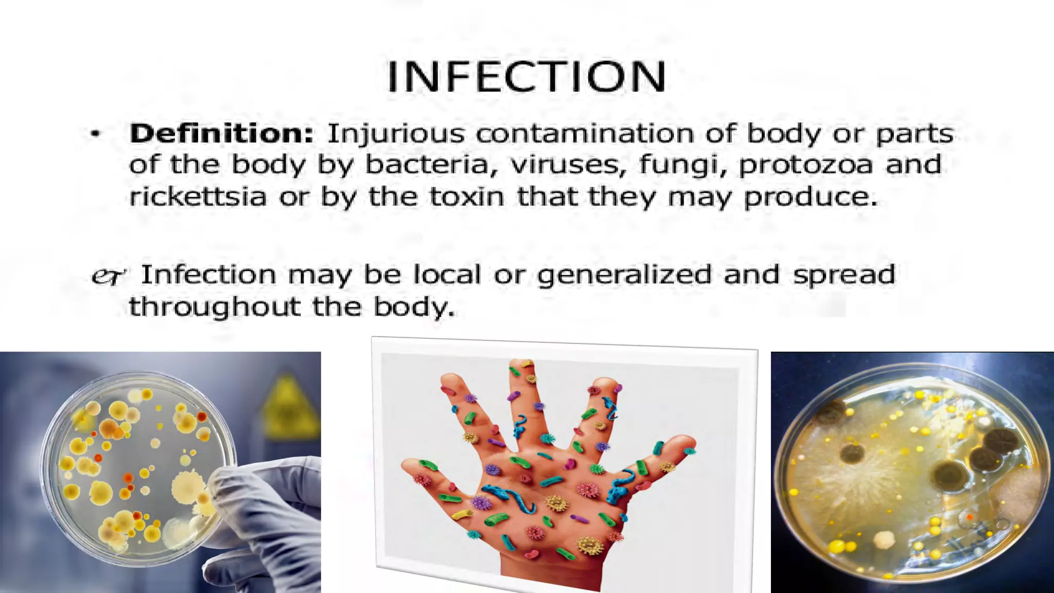 Infection Control and Prevention | PPT
