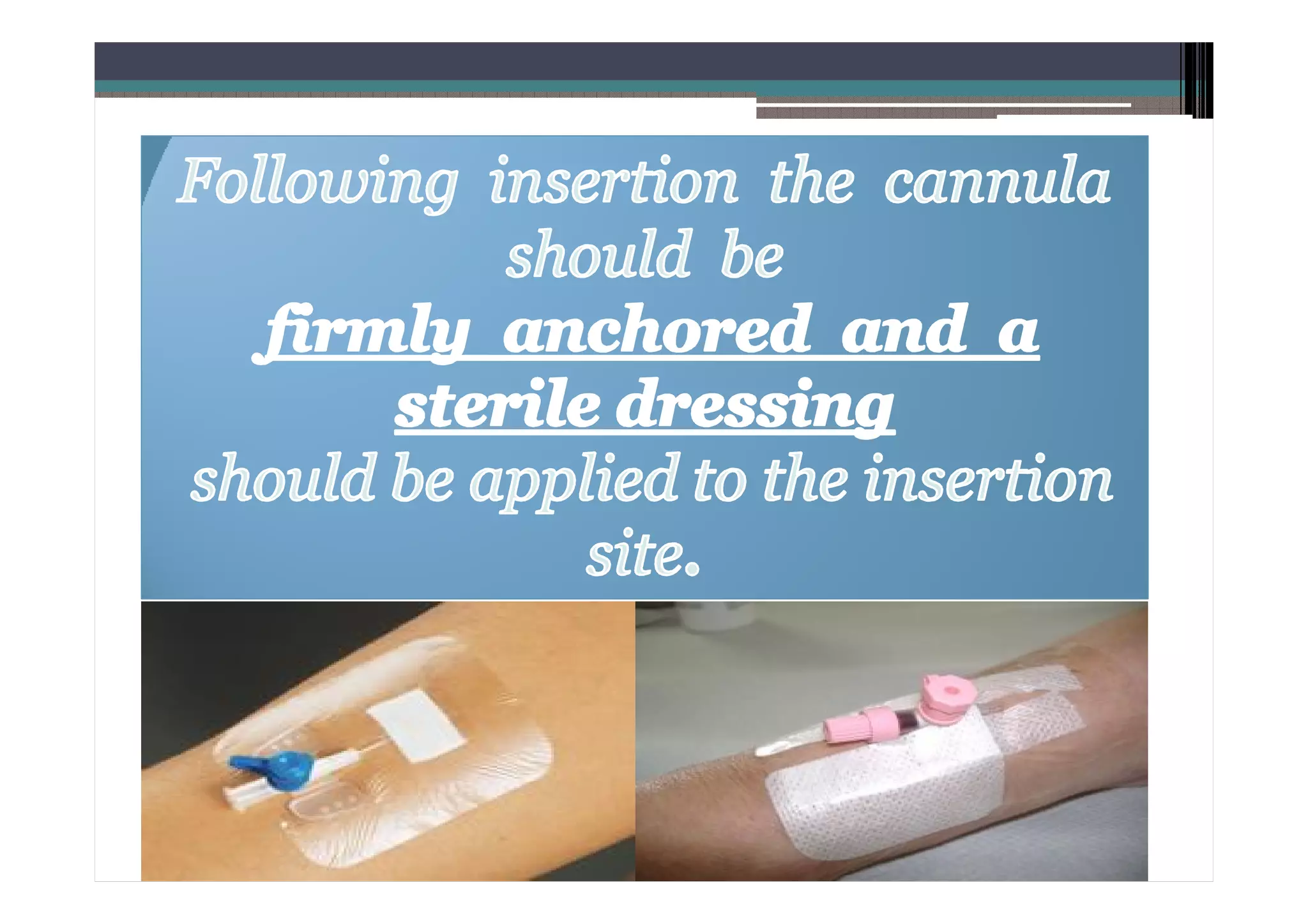 Infection control guidelines for Prevention of Peripheral Venous ...