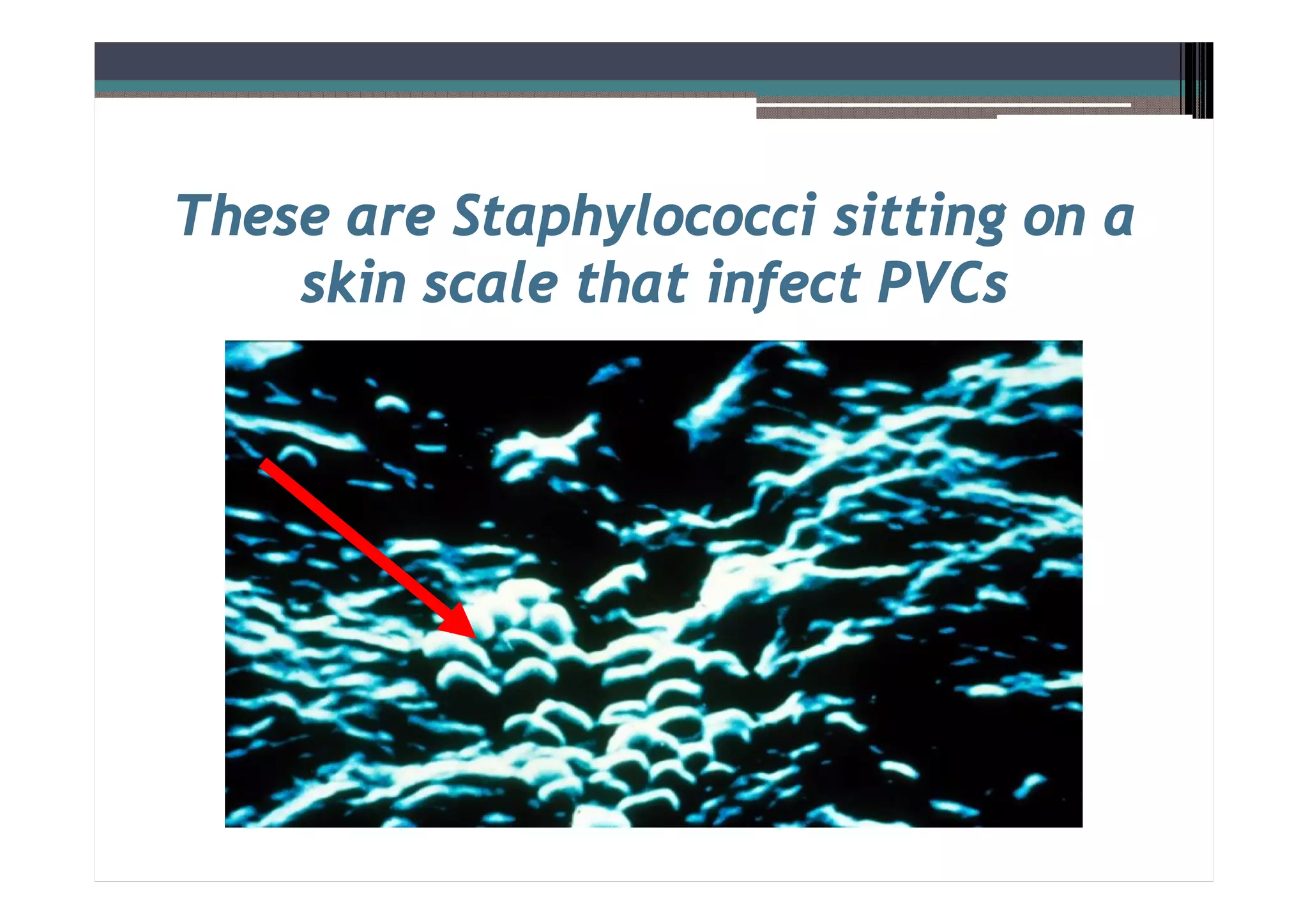 Infection control guidelines for Prevention of Peripheral Venous ...