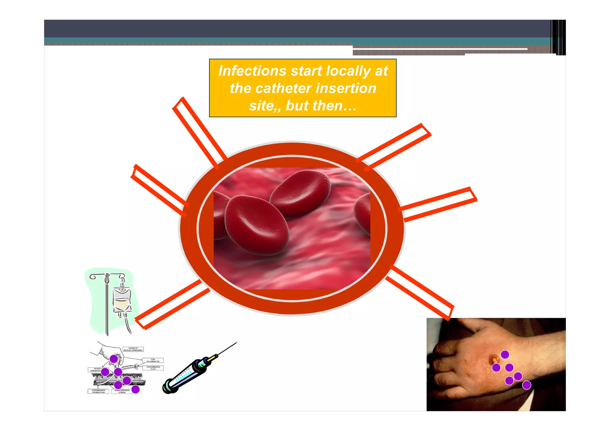 Infection control guidelines for Prevention of Peripheral Venous ...