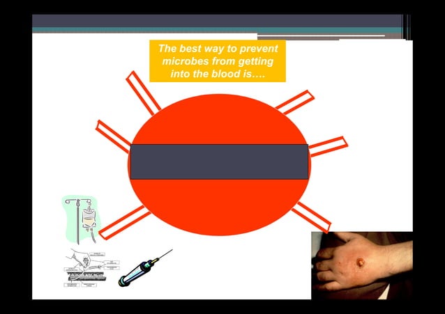 Infection control guidelines for Prevention of Peripheral Venous ...