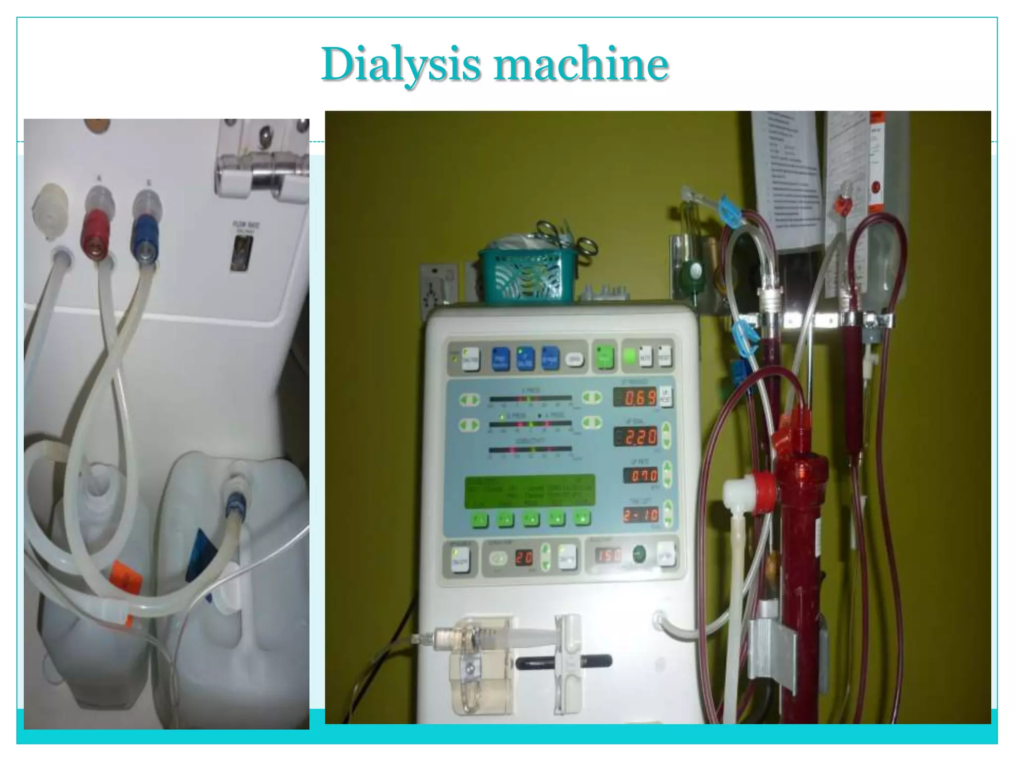 Infection Control in Dialysis Unit.ppt by Yo fINAL.ppt