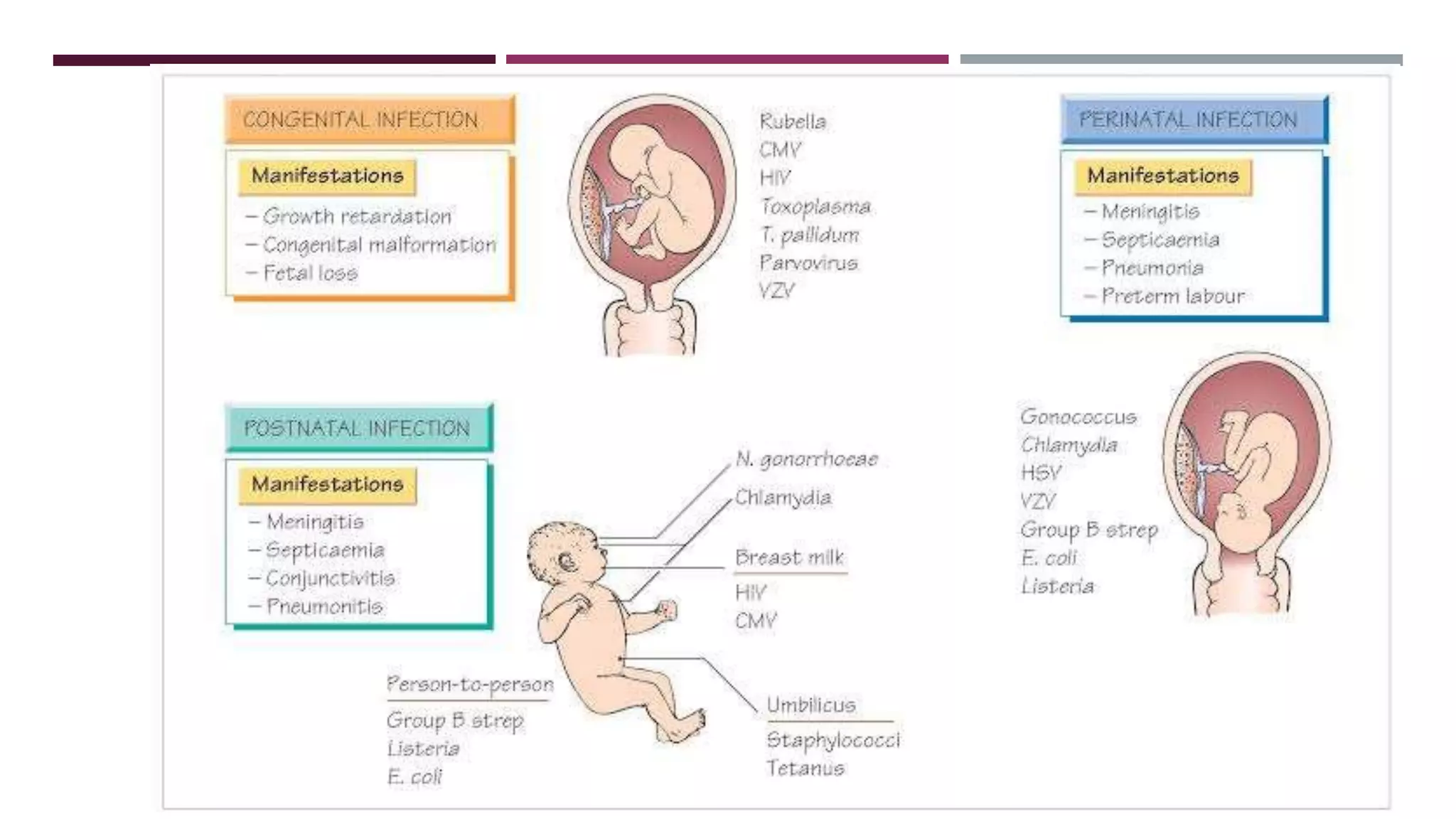 Infection control in newborns | PPTX