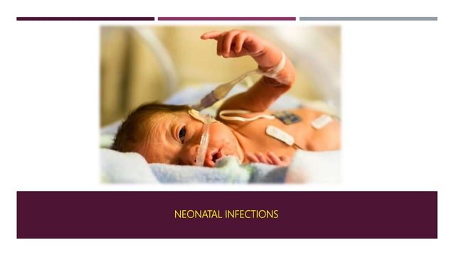 Infection control in newborns | PPTX
