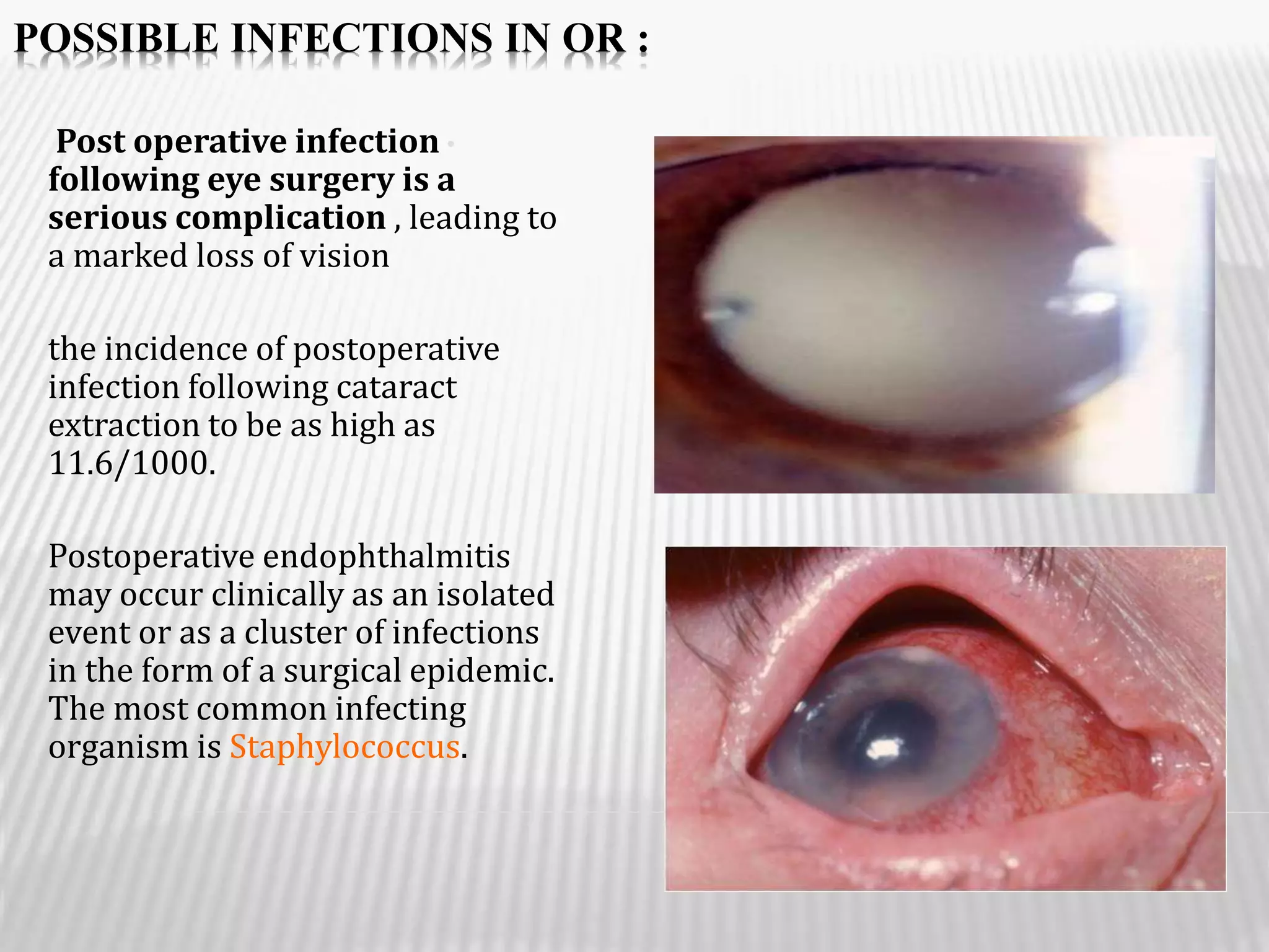 Infection control in ophthalmology or | PPTX