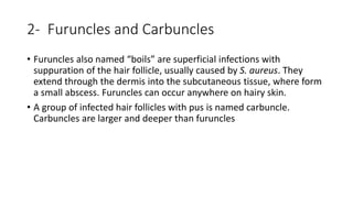 infection cutanées recommandations 2023p | PPT