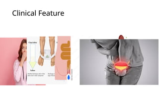 Infection during pregnancy,Perinatal infection accounts for 2-3% of ...